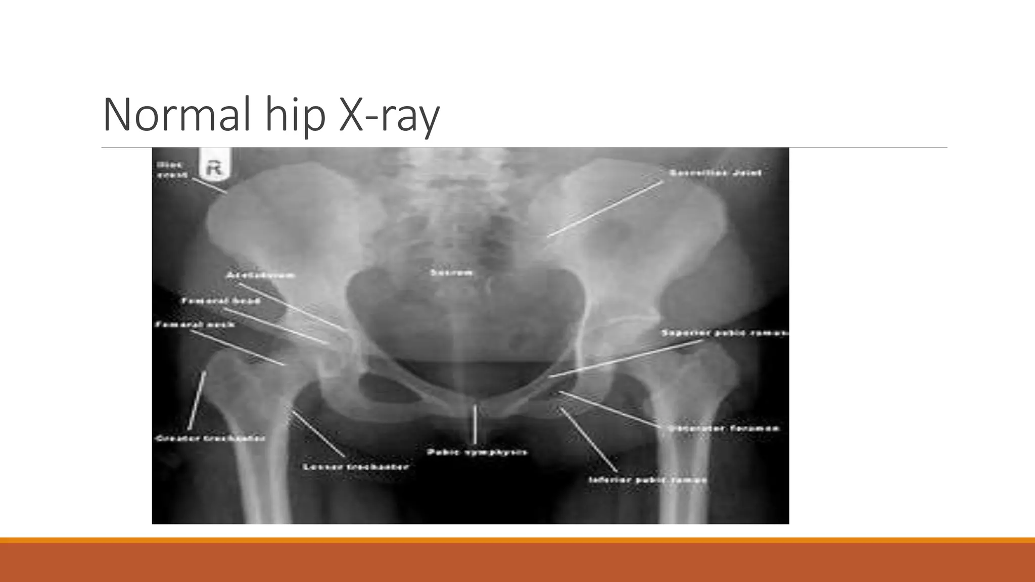 Interpretation of normal radiograph | PPTX