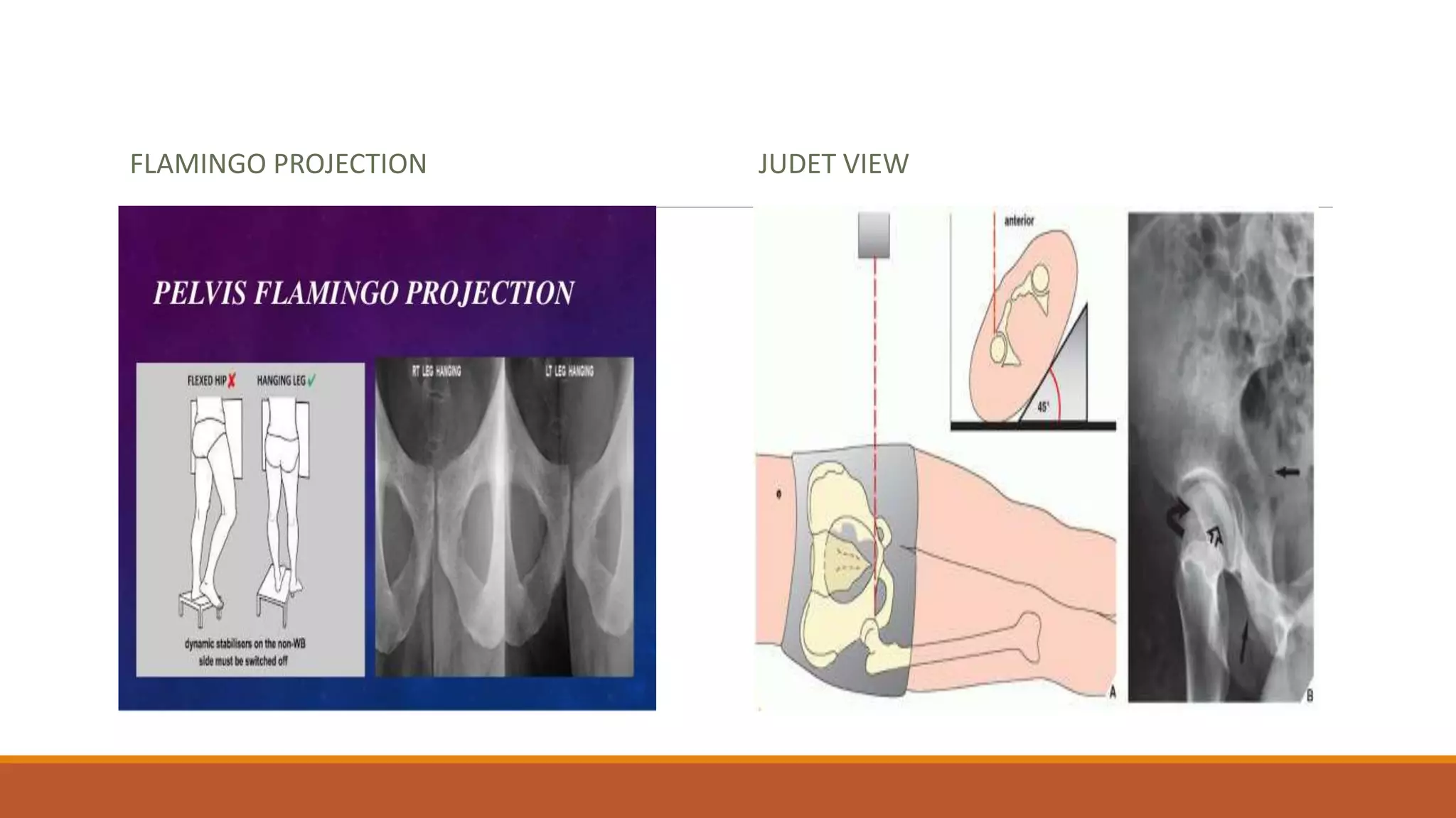Interpretation of normal radiograph | PPTX