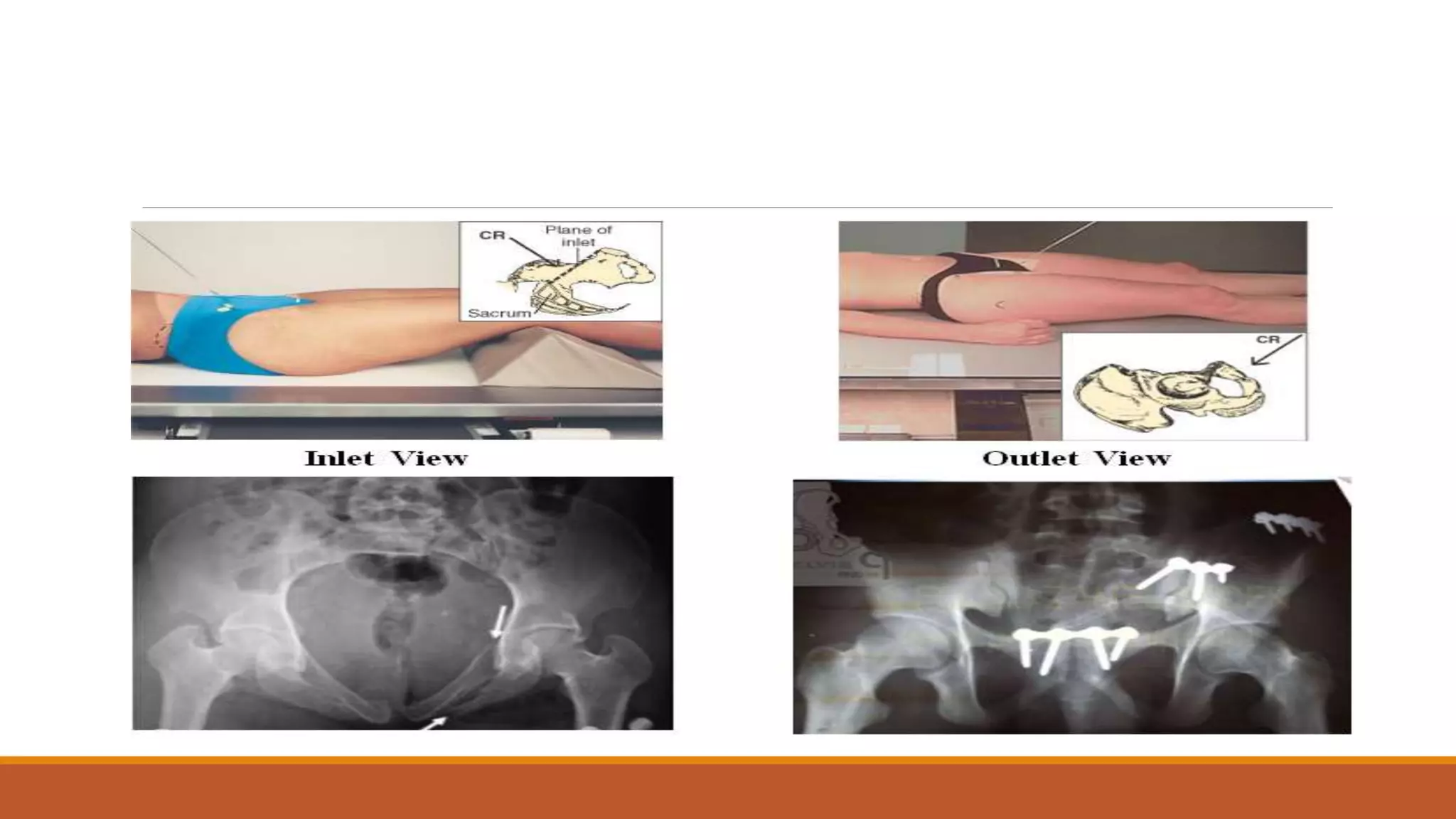 Interpretation of normal radiograph | PPTX