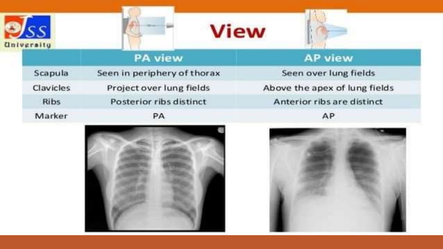 Interpretation of normal radiograph | PPTX | Death, Injury, or Military ...