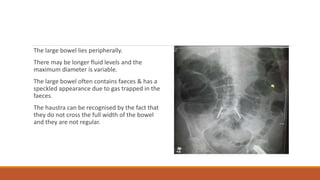Interpretation of normal radiograph | PPTX