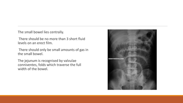 Interpretation of normal radiograph | PPTX | Death, Injury, or Military ...