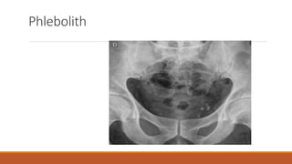 Interpretation of normal radiograph | PPTX