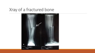 Interpretation of normal radiograph | PPTX