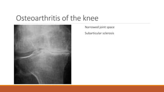 Interpretation of normal radiograph | PPTX