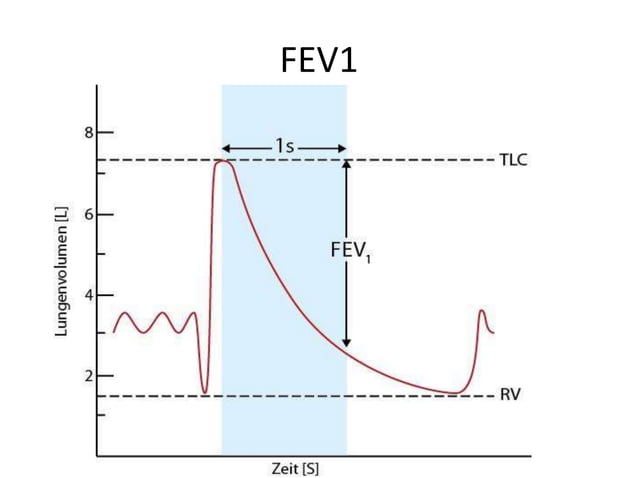 Interpretation of Pulmonary Function Test | PPTX | Lung and Respiratory ...