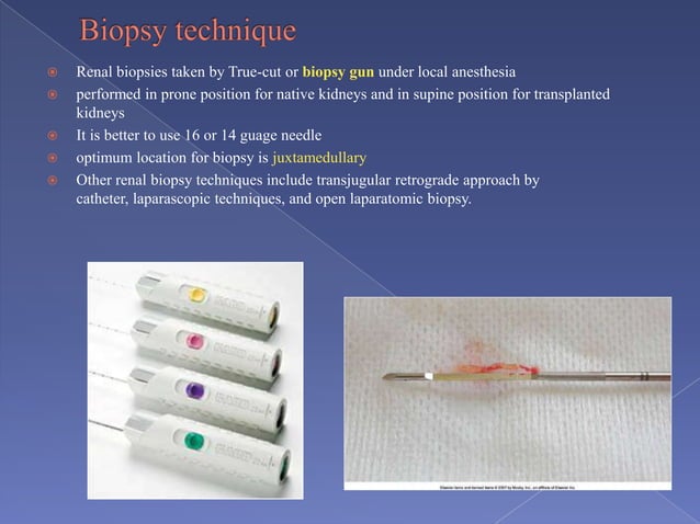 Interpretation of renal biopsy | PPTX