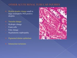 Interpretation of renal biopsy | PPTX