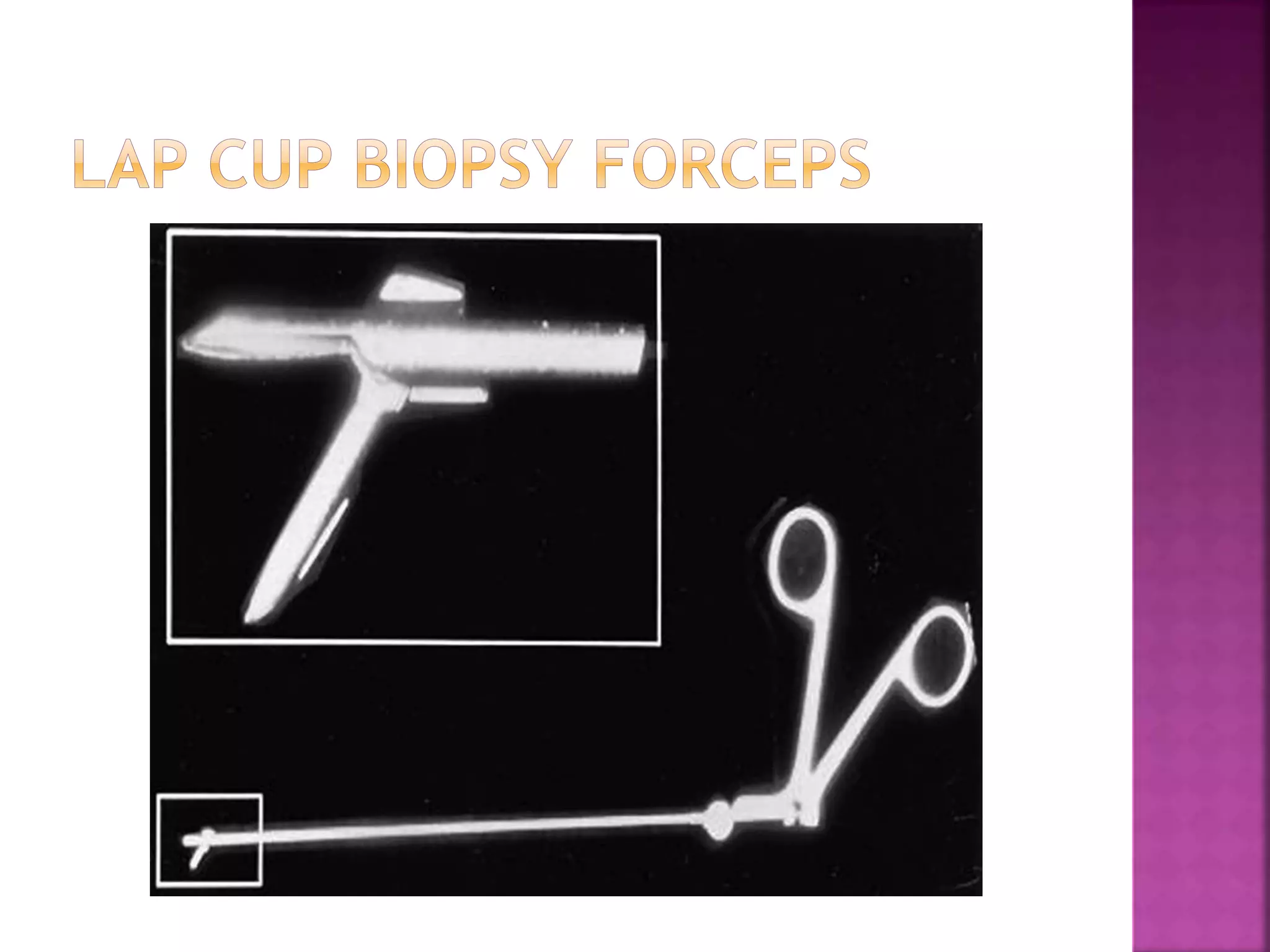 Interpretation of Renal Biopsy | PPTX