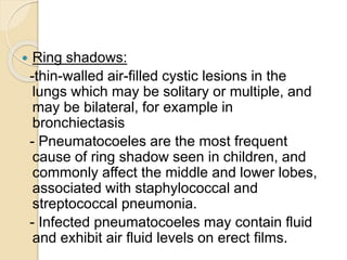 Interpretation of the paediatric chest x ray 1 | PPTX