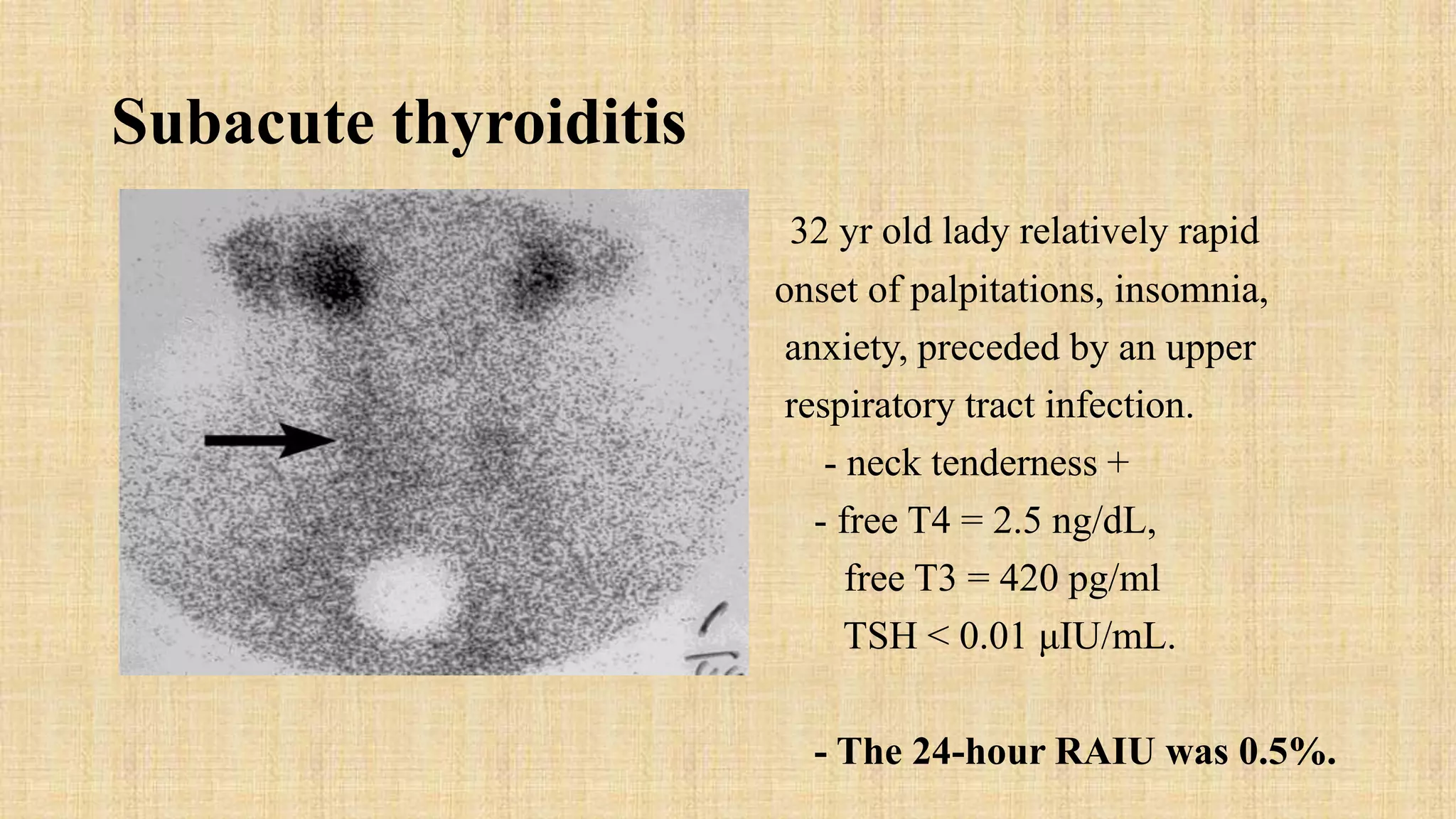 Interpretation Of Thyroid Function Tests And Scanpptx Thyroid Disorders Endocrine And