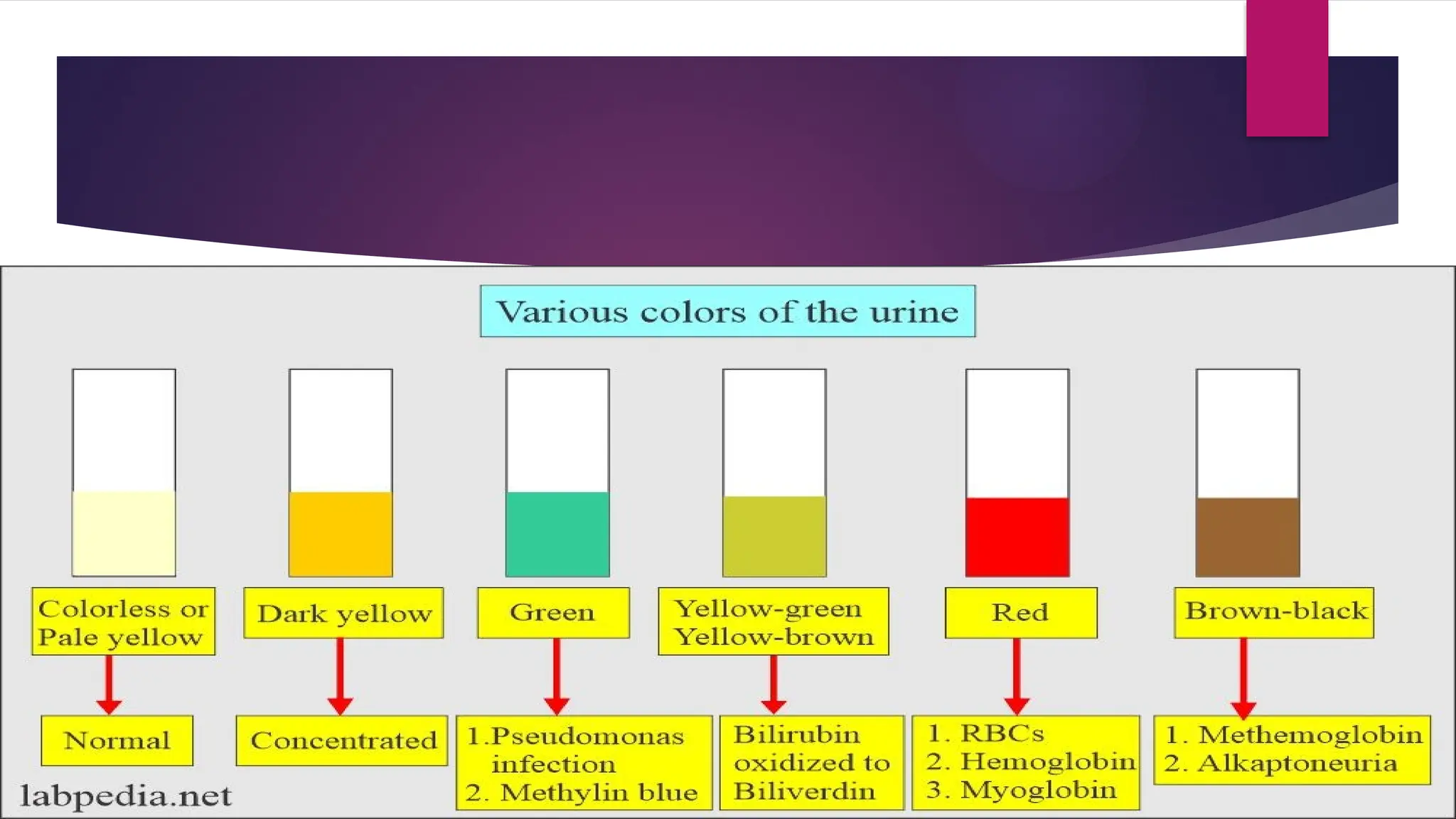 INTERPRETATION OF URINALYSIS BY DR. ONUORAH PRINCESS .pptx