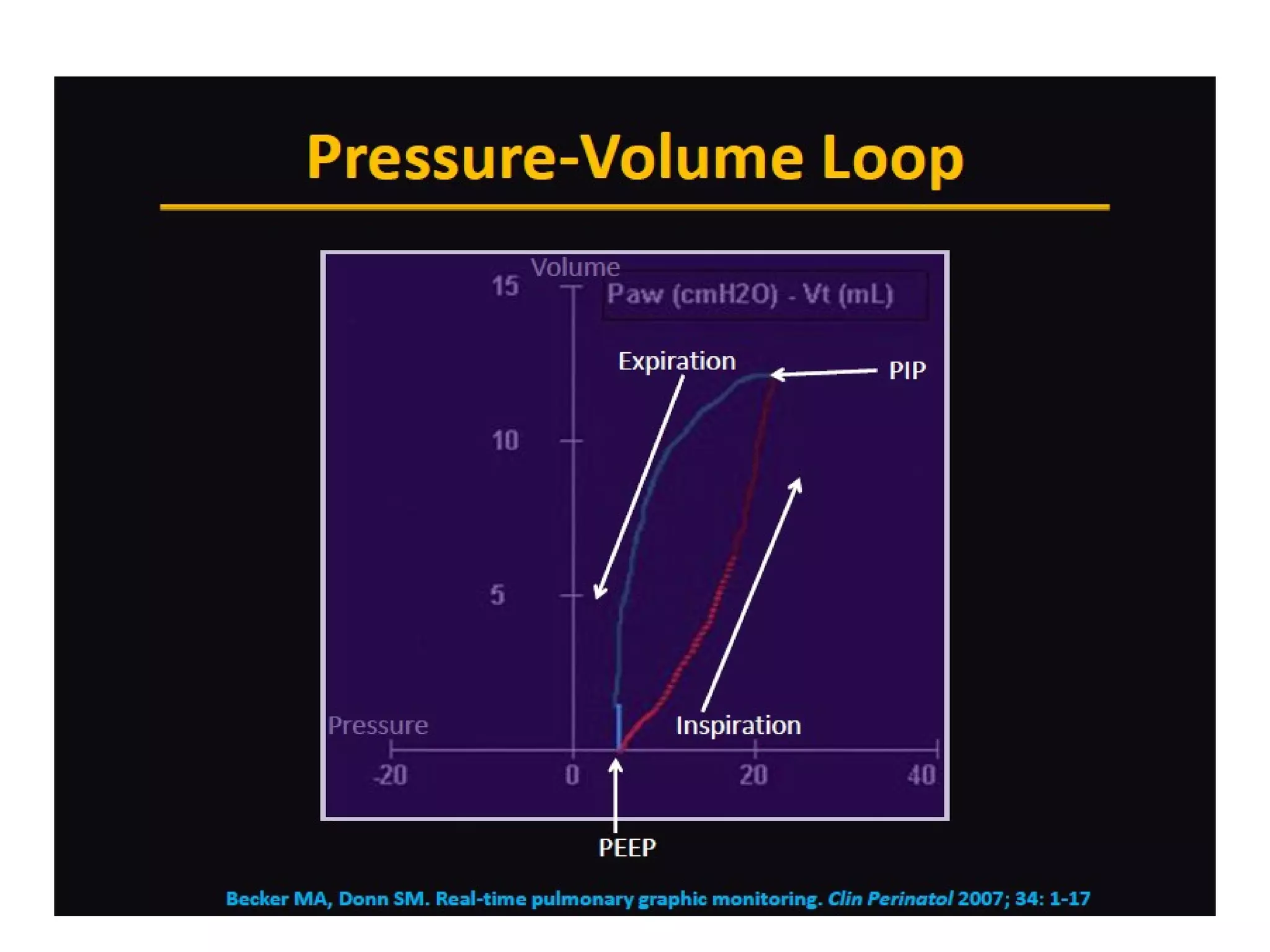 Interpretation of ventilator graphics | PPT Interpretation of ventilator graphics | PPT