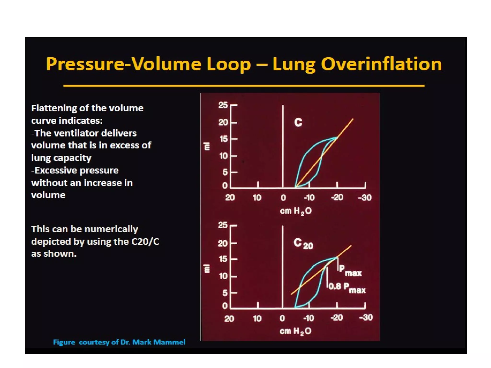 Interpretation of ventilator graphics | PPT Interpretation of ventilator graphics | PPT