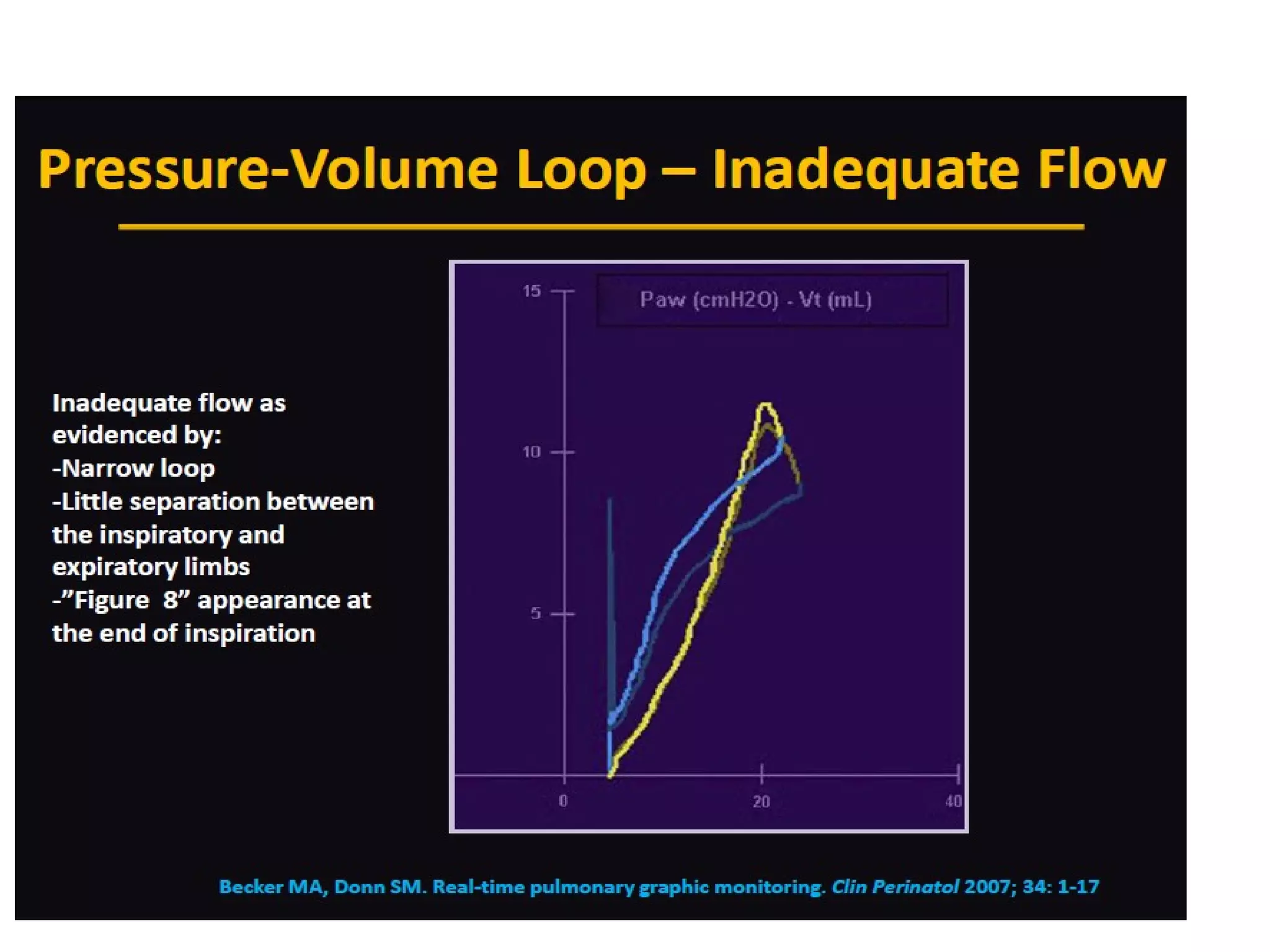 Interpretation of ventilator graphics | PPT Interpretation of ventilator graphics | PPT