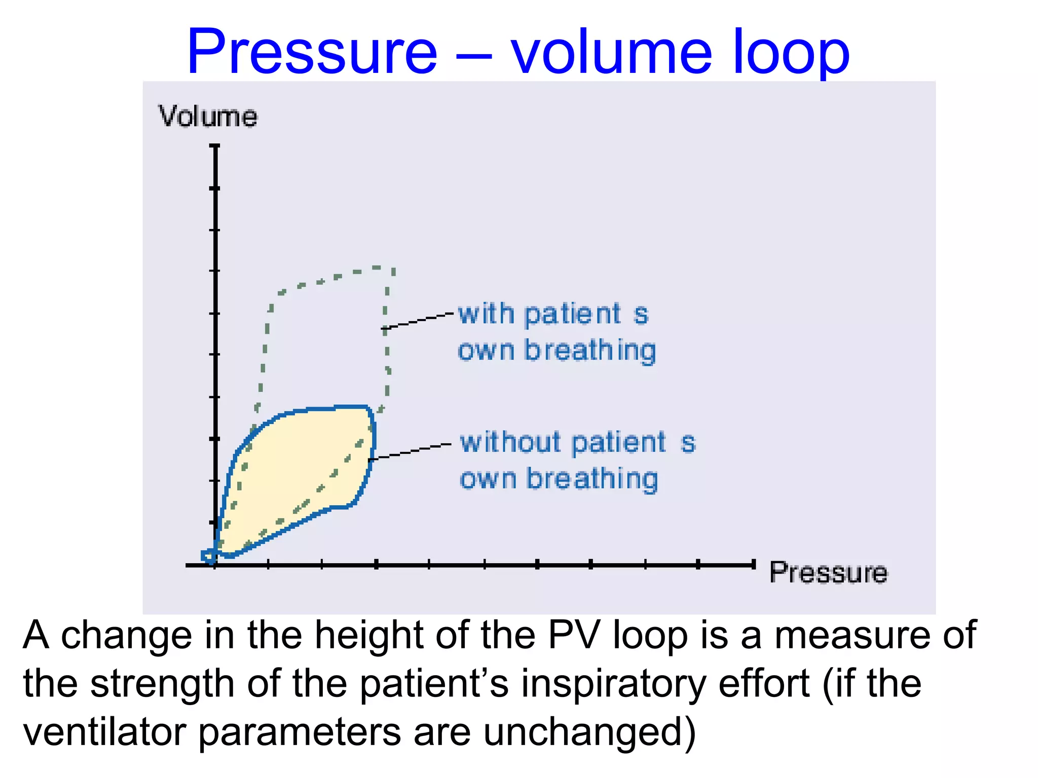 Interpretation of ventilator graphics | PPT Interpretation of ventilator graphics | PPT