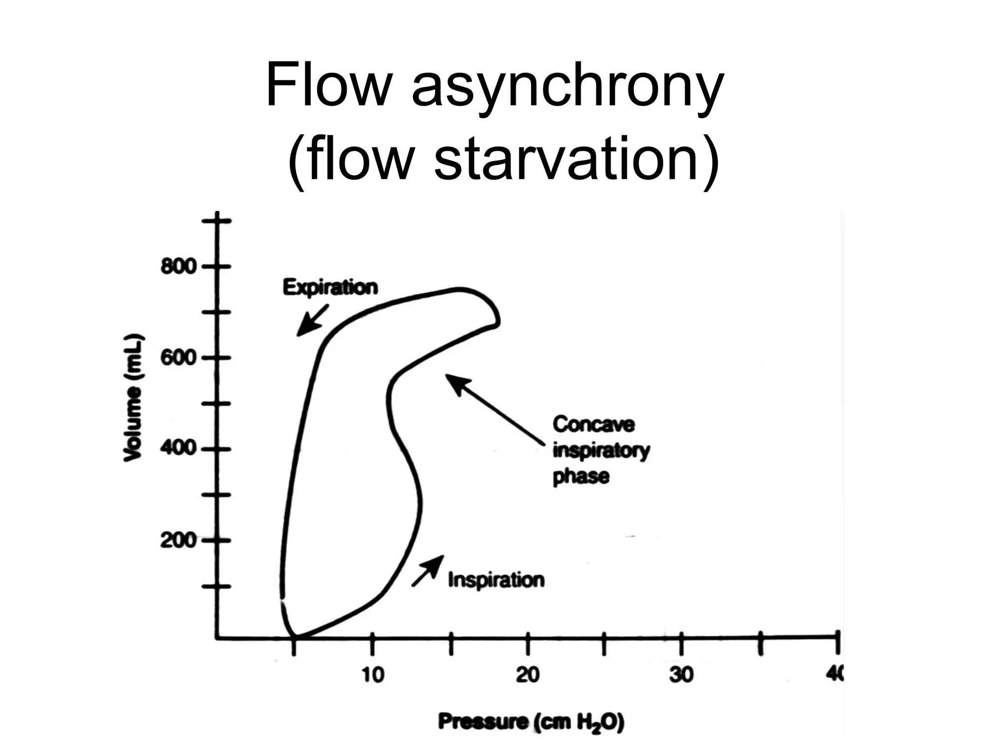 Interpretation of ventilator graphics | PPT