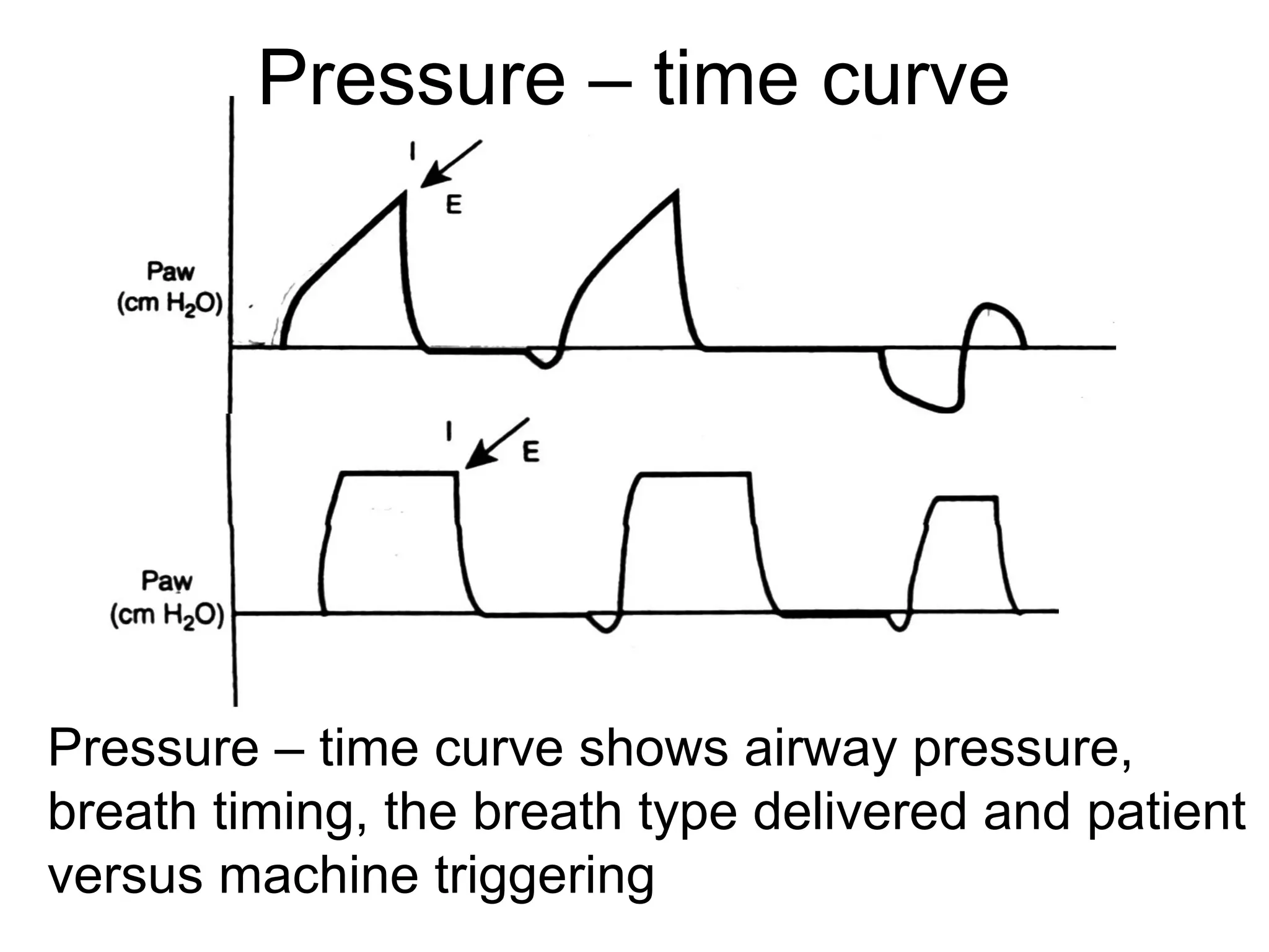 Interpretation of ventilator graphics | PPT Interpretation of ventilator graphics | PPT