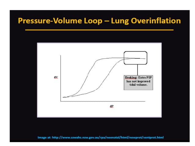 Interpretation of ventilator graphics | PPT Interpretation of ventilator graphics | PPT