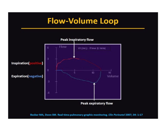 Interpretation of ventilator graphics | PPT