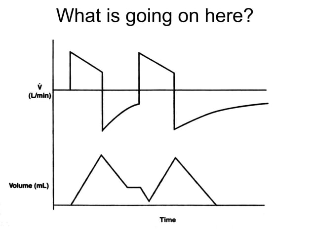 Interpretation of ventilator graphics | PPT