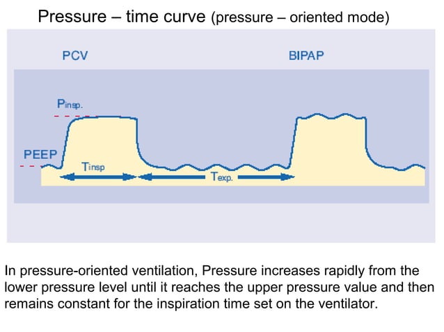 Interpretation of ventilator graphics | PPT