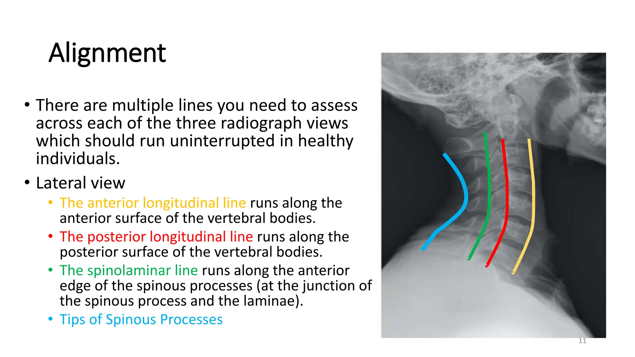 Interpretation of Xrays of the spine.pptx