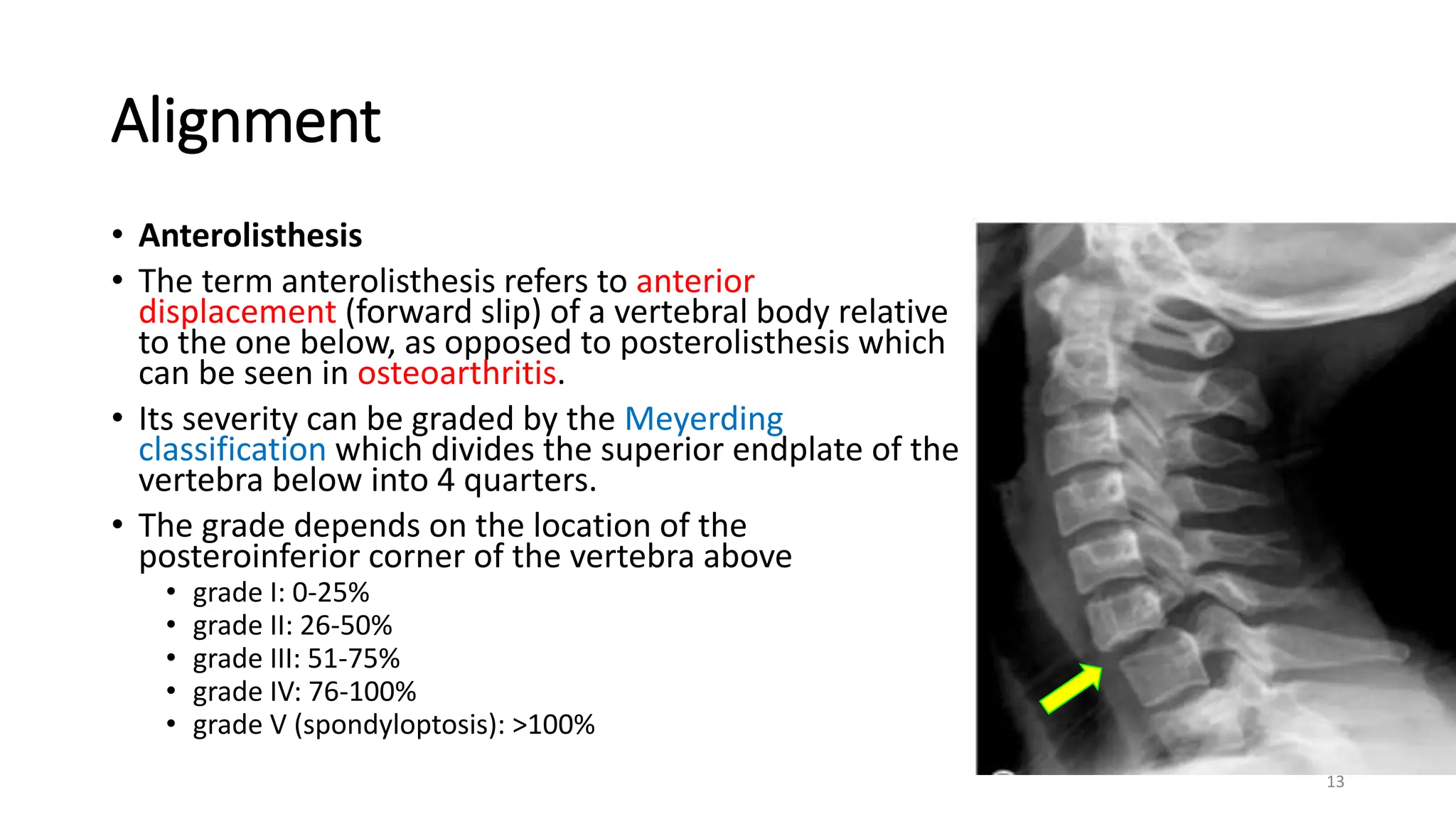 Interpretation of Xrays of the spine.pptx