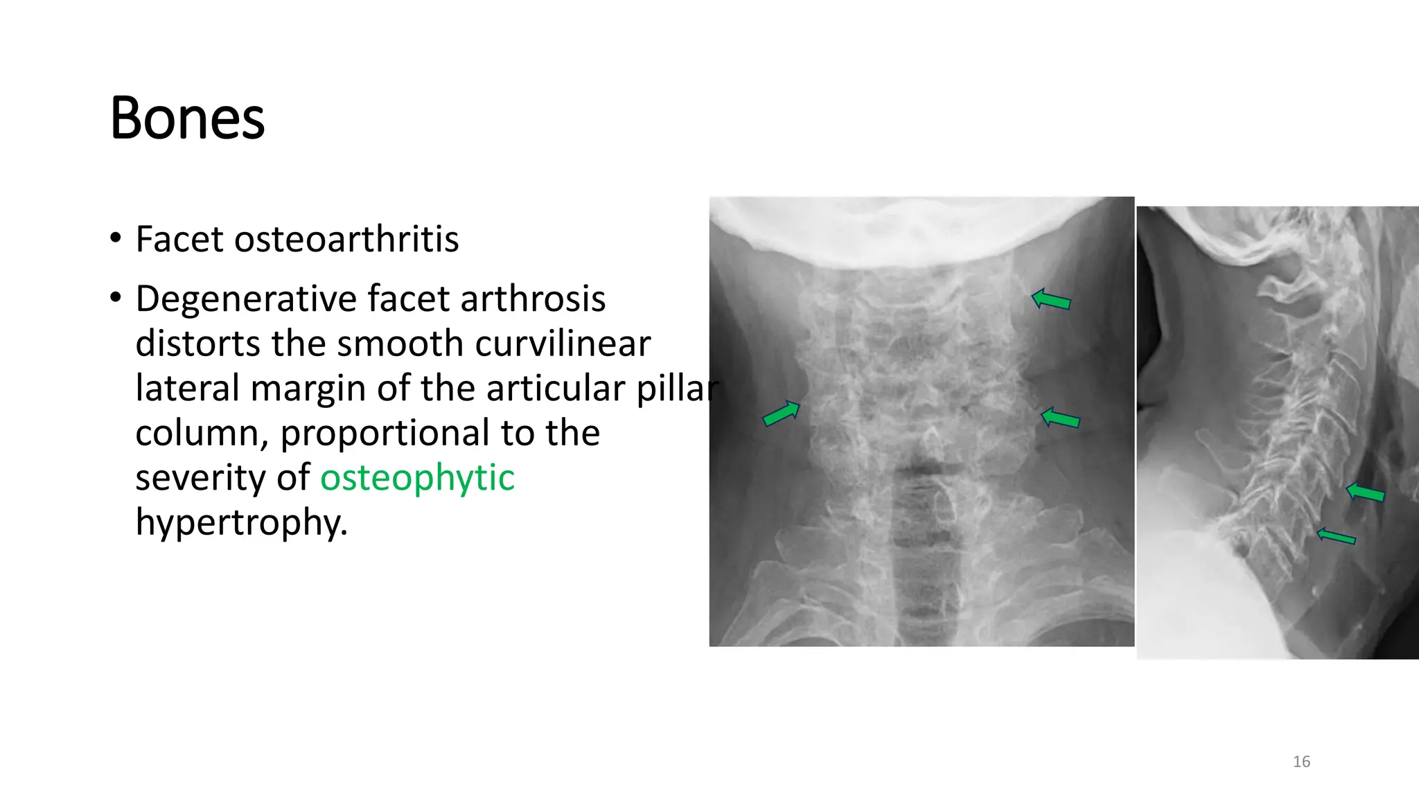 Interpretation of Xrays of the spine.pptx