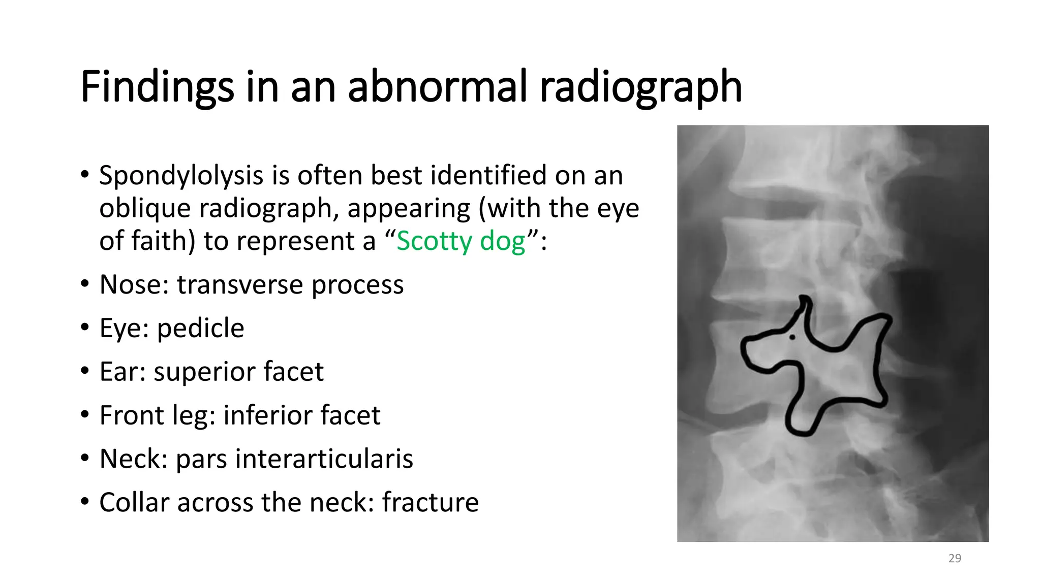 Interpretation of Xrays of the spine.pptx