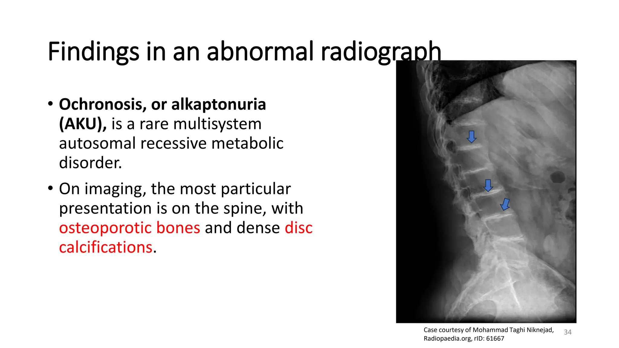 Interpretation of Xrays of the spine.pptx