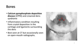 Interpretation of Xrays of the spine.pptx