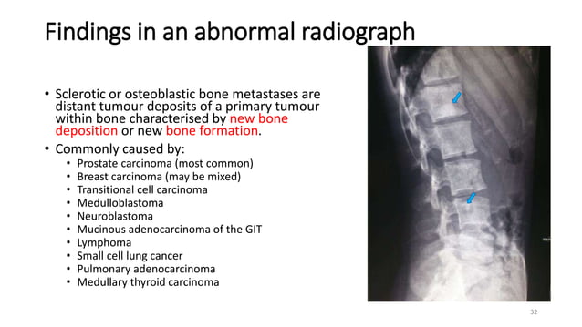 Interpretation of Xrays of the spine.pptx