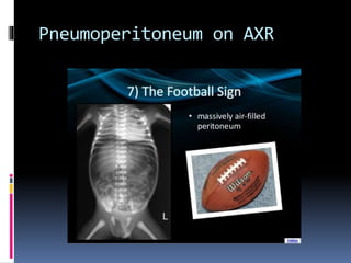 Interpret axr and imaging of gist system | PPTX
