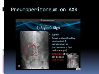 Interpret axr and imaging of gist system | PPTX