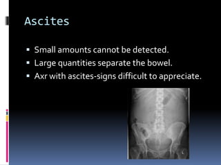 Interpret axr and imaging of gist system | PPTX