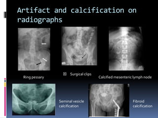Interpret axr and imaging of gist system | PPTX