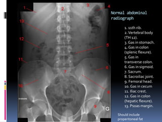 Interpret axr and imaging of gist system | PPTX