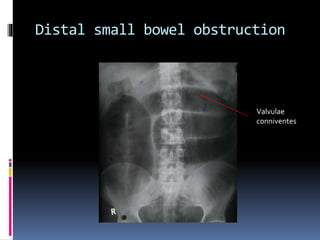 Interpret axr and imaging of gist system | PPTX