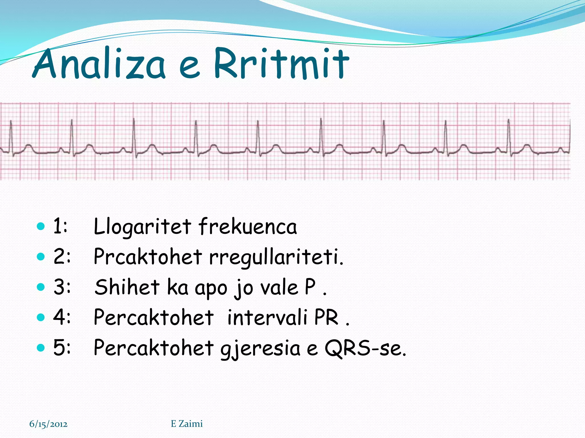 Interpretimi elektrokardiografik i crregullimeve te rritmit | PPSX