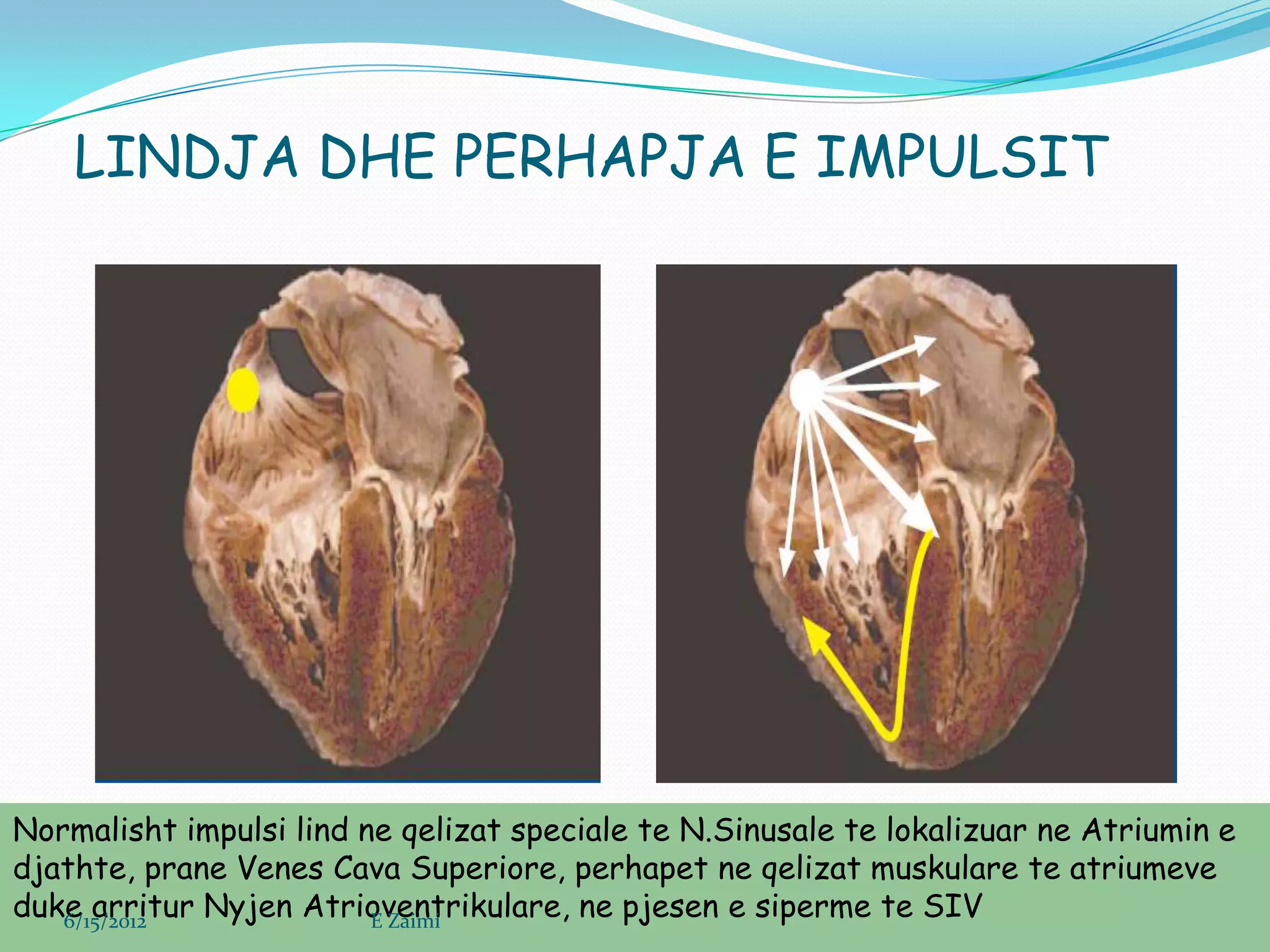 Interpretimi elektrokardiografik i crregullimeve te rritmit | PPSX