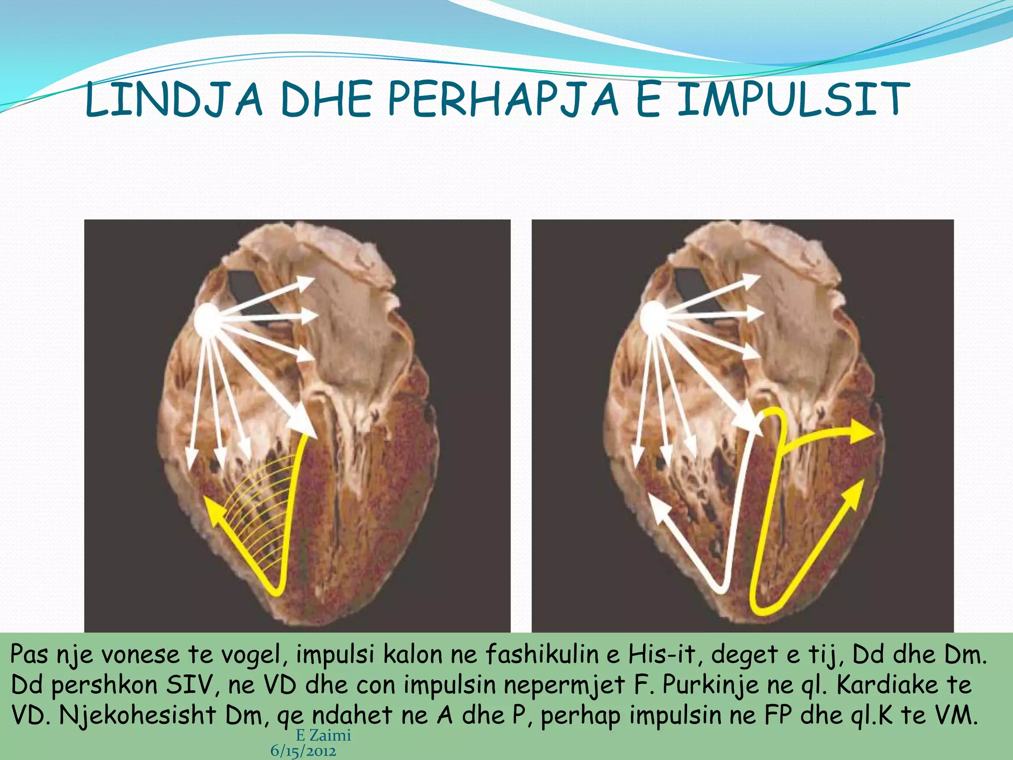 Interpretimi elektrokardiografik i crregullimeve te rritmit | PPSX
