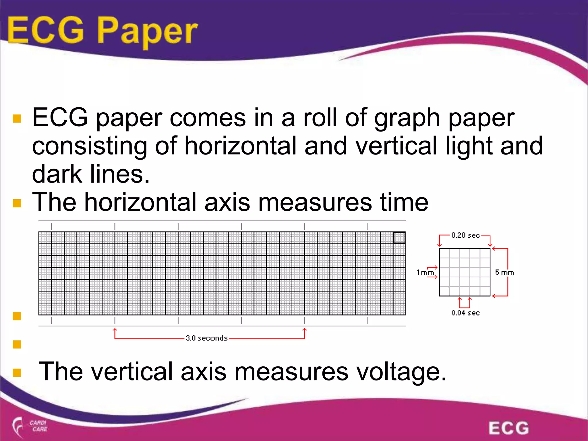 Interpreting ecg | PPTX