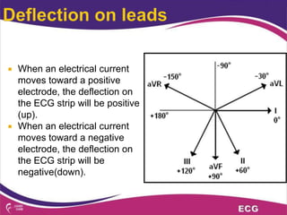 Interpreting ecg | PPTX