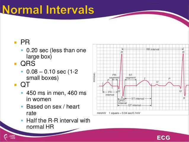 Interpreting ecg