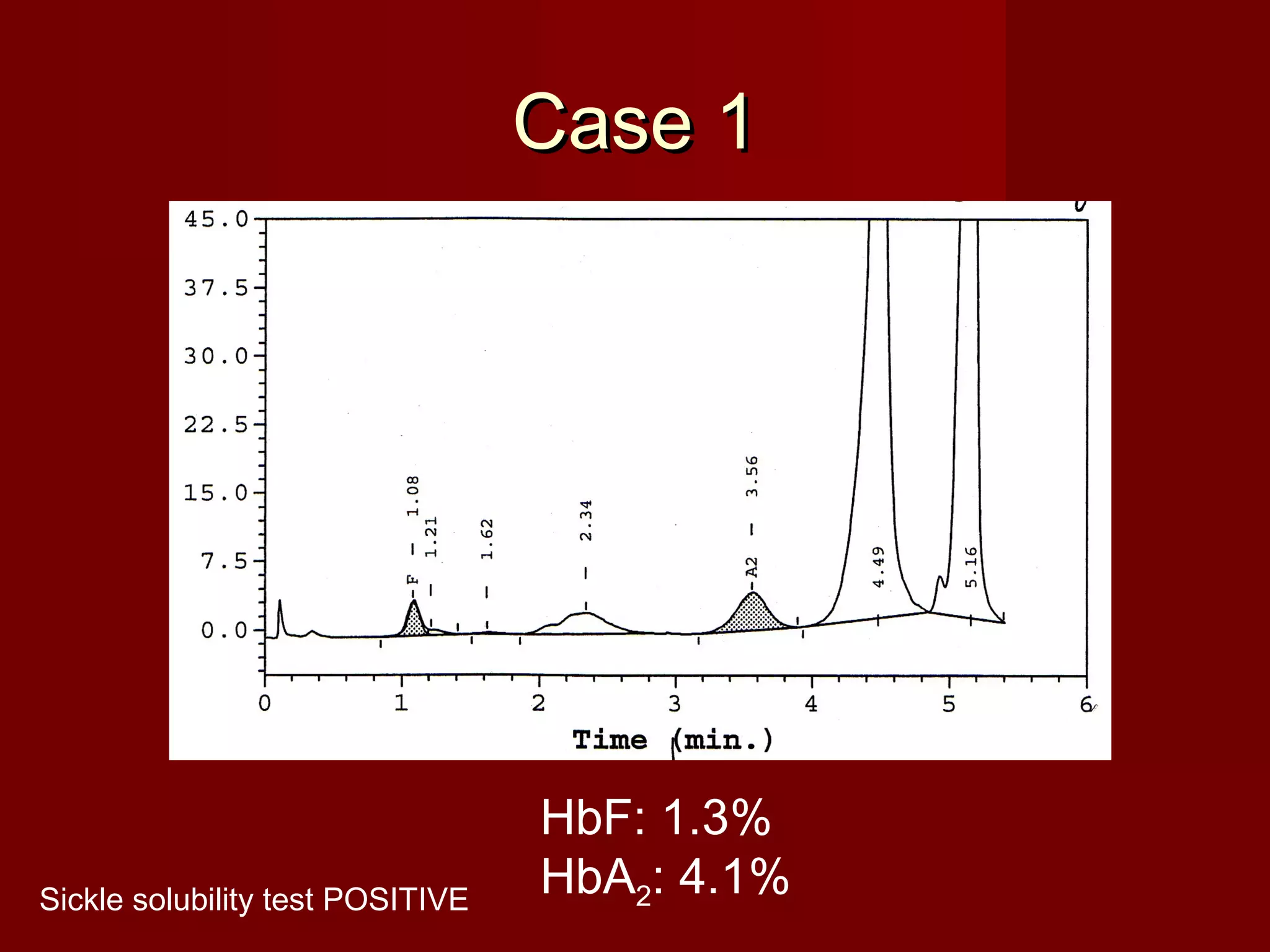 Interpreting Abnormal hemoglobin study | PPT