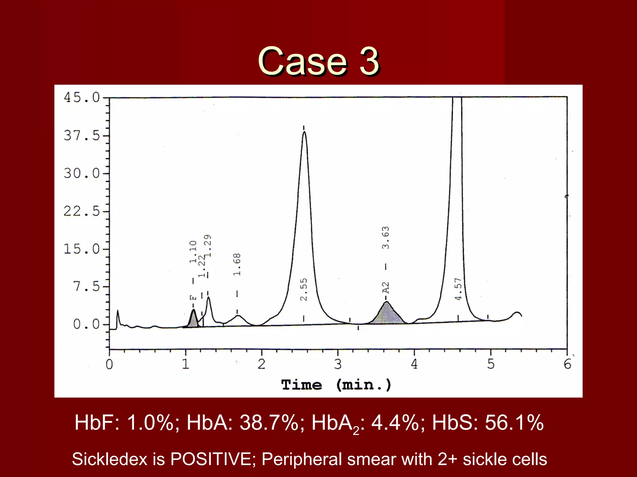 Interpreting Abnormal hemoglobin study | PPT