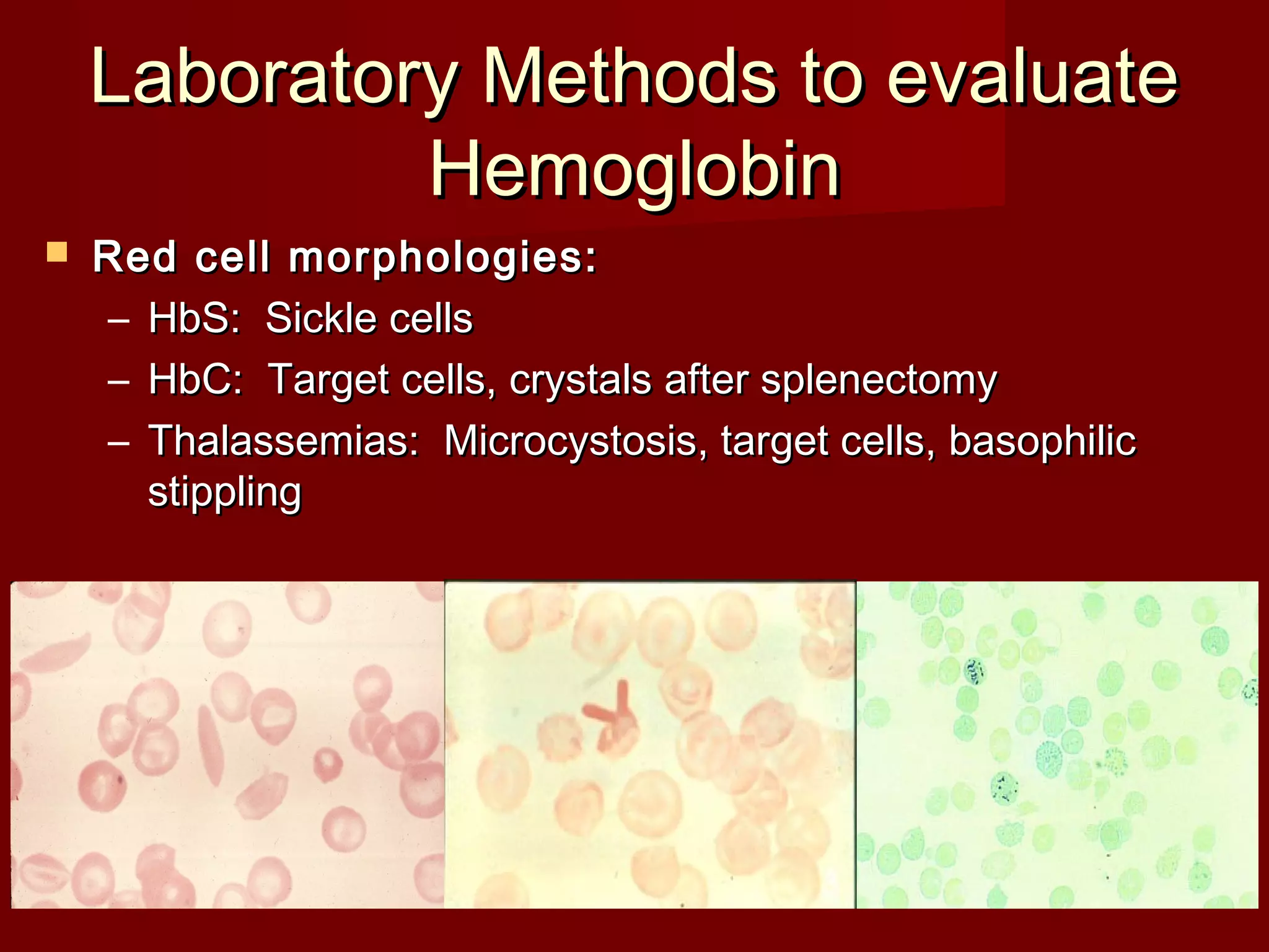 Interpreting Abnormal hemoglobin study | PPT