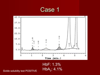 Interpreting Abnormal hemoglobin study | PPT