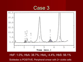 Interpreting Abnormal hemoglobin study | PPT